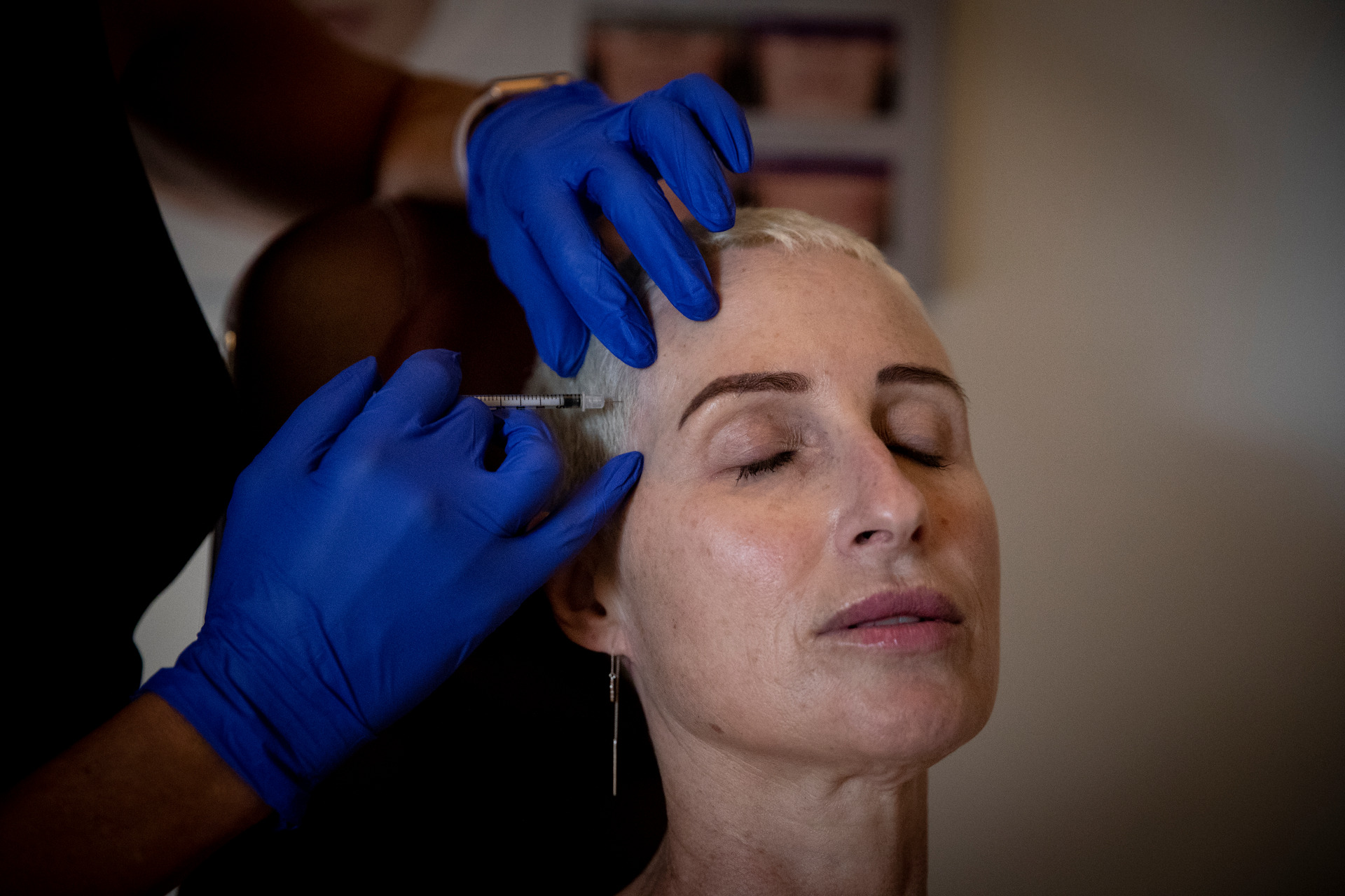 Botox for Migraines in Vaughan, ON | Relieve Migraine Pain